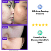 Eclipse® Light Therapy Skincare Wand | With Red and Green Light Therapy ...